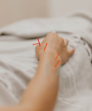 Acupuncture in NYC - Relieve Pain, Stress, Anxiety & More | WTHN